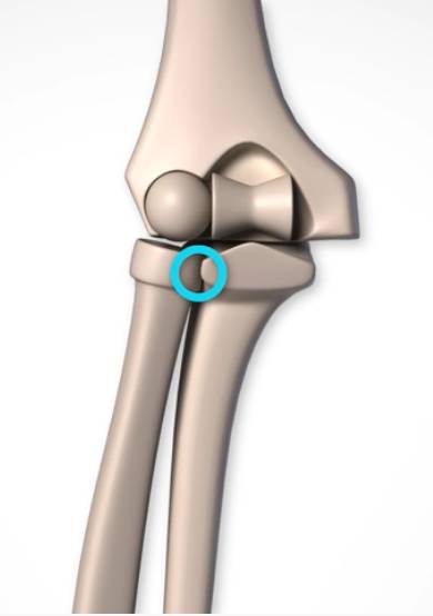 6 Types Of Joints: Human Anatomy – Welcome to SYS Medtech International ...